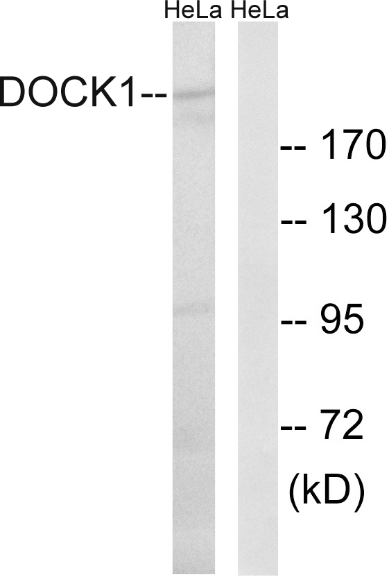 Anti-DOCK1 (Rabbit Polyclonal) for WB & ELISA | Human & Mouse