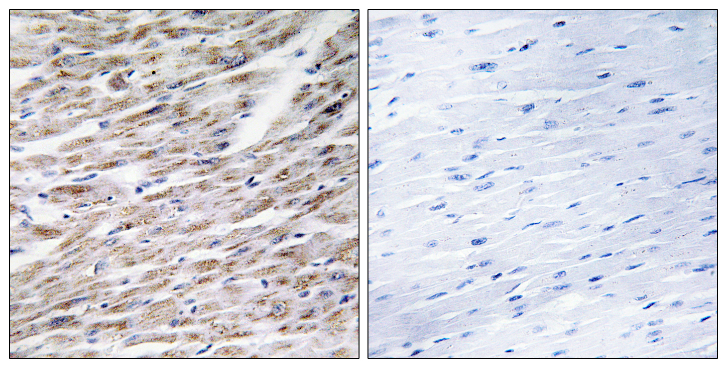 GZMA antibody | Anti-GZMA | stjohnslabs