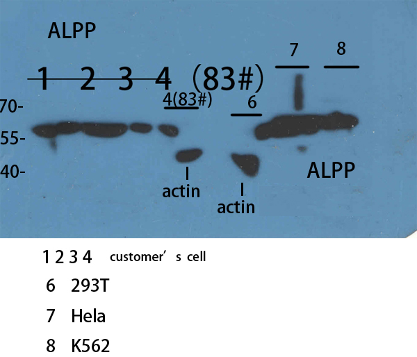 ALPP/ALPPL2 antibody | Anti-ALPP/ALPPL2 | stjohnslabs