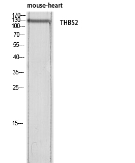 THBS2 antibody | Anti-THBS2 | stjohnslabs