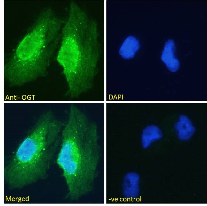 OGT antibody | Anti-OGT | stjohnslabs