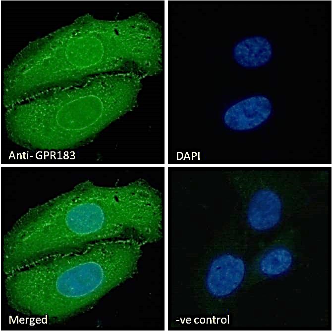 GPR183 antibody | Anti-GPR183 | stjohnslabs