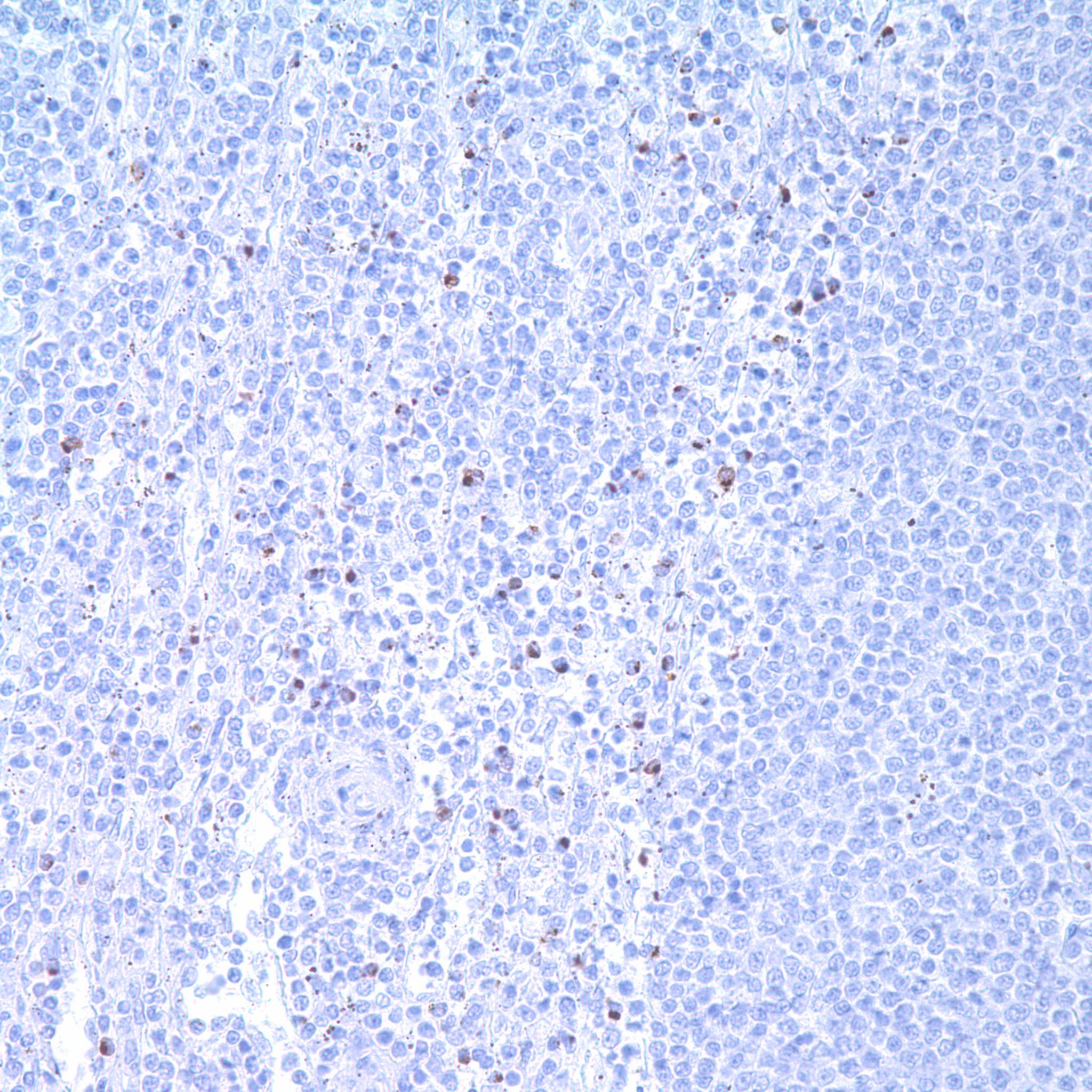 Perforin antibody | Anti-Perforin | stjohnslabs