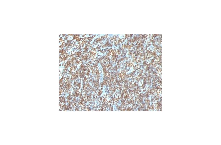 Double strand DNA antibody | Anti-Double strand DNA | stjohnslabs