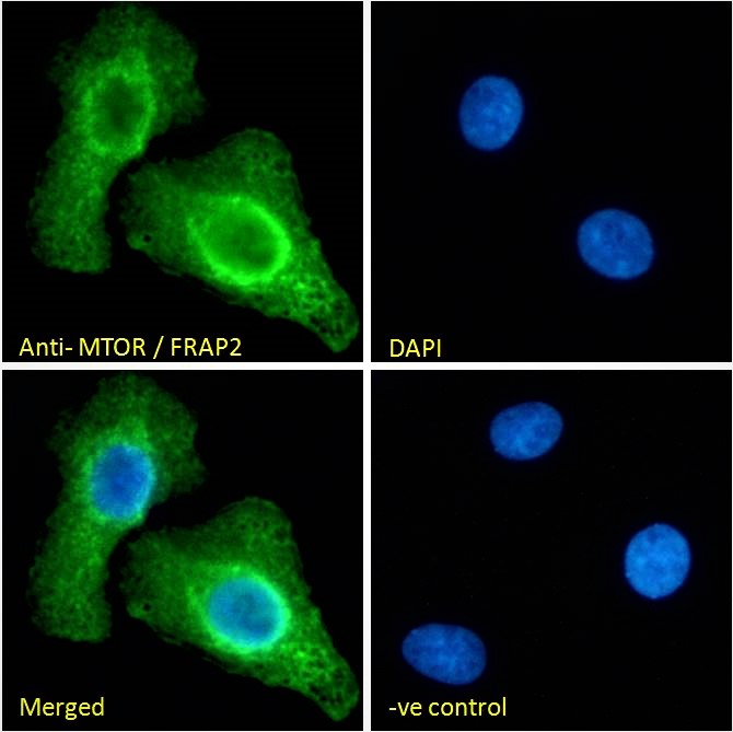 MTOR/FRAP2 antibody | Anti-MTOR/FRAP2 | stjohnslabs