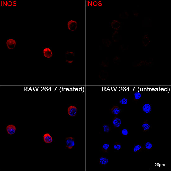 iNOS antibody | Anti-iNOS | stjohnslabs