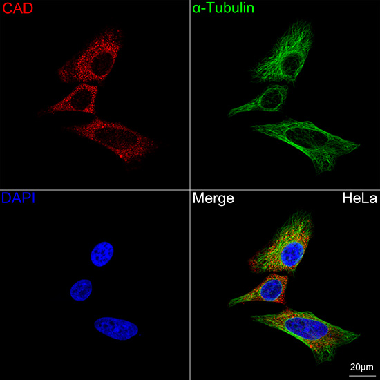 Anti-CAD (Rabbit Monoclonal) for WB, IHC-P, IF, ICC & ELISA | Human & Mouse