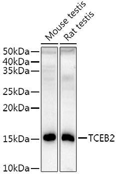 Anti-ELOB rabbit monoclonal antibody [S4190RM] - WB & ELISA