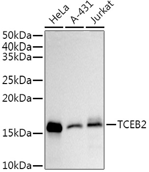 Anti-ELOB rabbit monoclonal antibody [S4190RM] - WB & ELISA