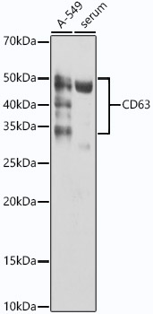 Anti-CD63 rabbit monoclonal antibody [S4602RM] - WB, IHC-P & ELISA