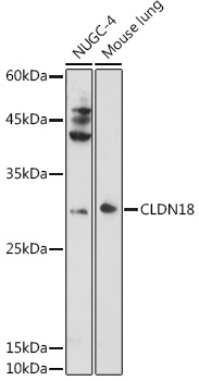 Anti-CLDN18 rabbit polyclonal antibody - WB & ELISA
