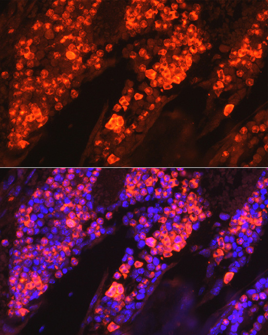 Anti-MPO rabbit polyclonal antibody - IF, ICC & ELISA