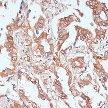 Anti-PTPRN2 rabbit polyclonal antibody - WB, IHC-P & ELISA