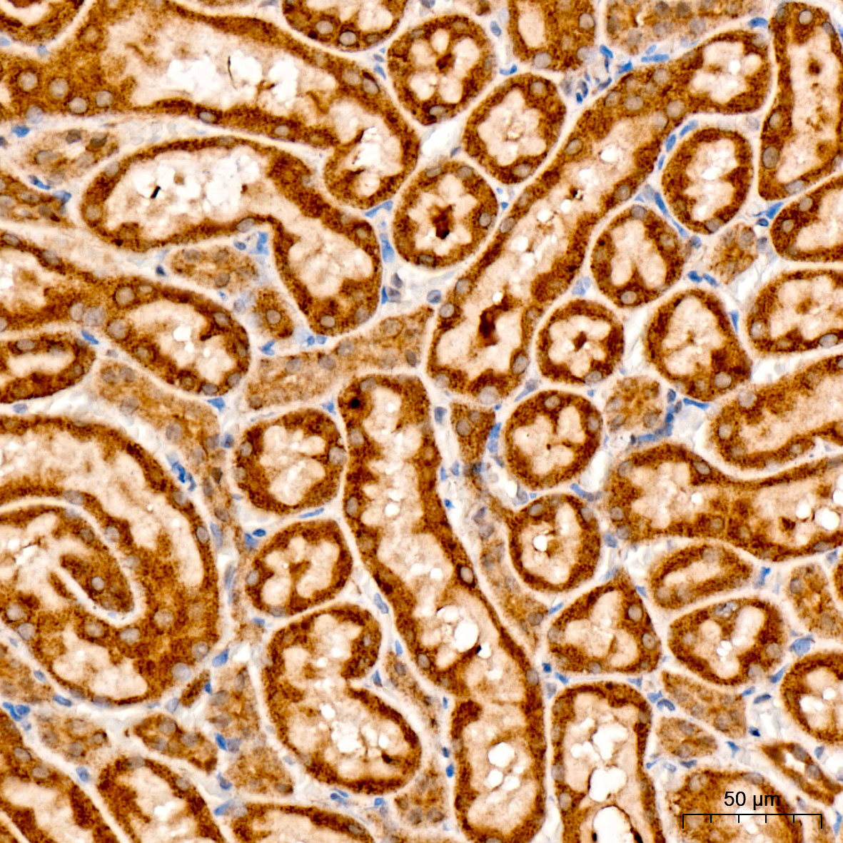 Anti-CHAC1 rabbit polyclonal antibody - WB, IHC-P, IF, ICC & ELISA