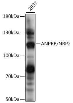 Anti-NPR2 rabbit polyclonal antibody - WB & ELISA