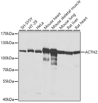Anti-ACTN2 rabbit polyclonal antibody - WB, IHC-P, IF, ICC & ELISA