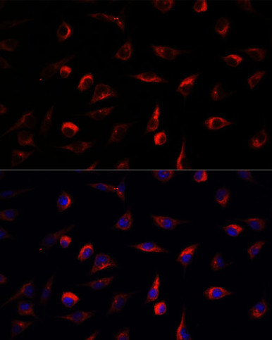 MAP2K7 antibody | Anti-MAP2K7 | stjohnslabs