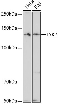 TYK2 antibody | Anti-TYK2 | stjohnslabs