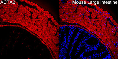 ACTA2 antibody | Anti-ACTA2 | stjohnslabs