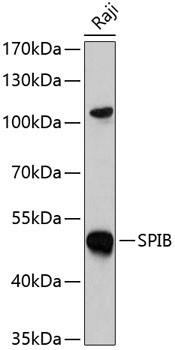 SPIB antibody | Anti-SPIB | stjohnslabs