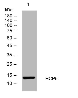 HCP5 antibody | Anti-HCP5 | stjohnslabs