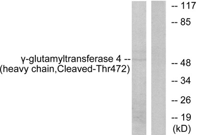 Cleaved-GGT7-T472 antibody | Anti-Cleaved-GGT7-T472 | stjohnslabs