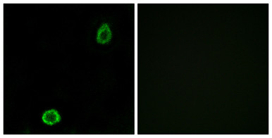 ABCA13 antibody | Anti-ABCA13 | stjohnslabs