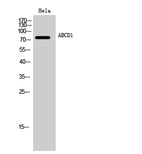 ABCD1 antibody | Anti-ABCD1 | stjohnslabs