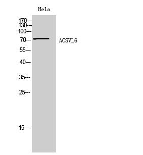 SLC27A5 antibody | Anti-SLC27A5 | stjohnslabs