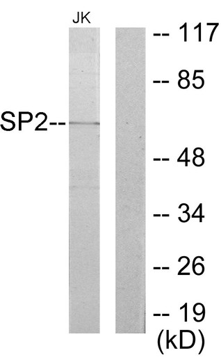 SP2 antibody | Anti-SP2 | stjohnslabs