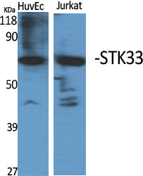 STK33 antibody | Anti-STK33 | stjohnslabs