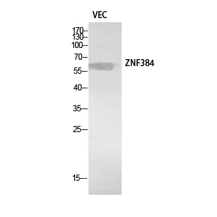 ZNF384 antibody | Anti-ZNF384 | stjohnslabs