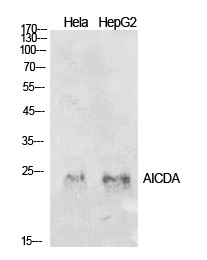 AICDA antibody | Anti-AICDA | stjohnslabs