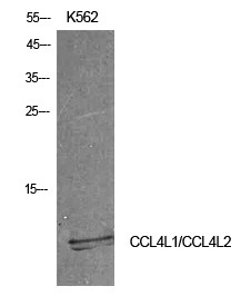 CCL4L1/CCL4L2 antibody | Anti-CCL4L1/CCL4L2 | stjohnslabs