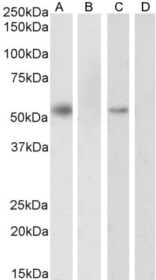 RXR alpha antibody | Anti-RXR alpha | stjohnslabs