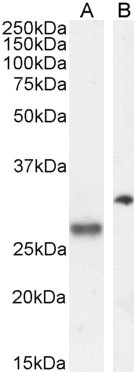 Proopiomelanocortin/POMC antibody | Anti-Proopiomelanocortin/POMC ...