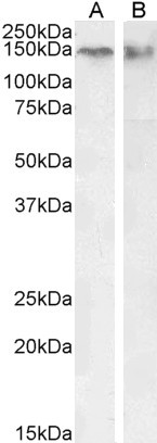 CTCF-Isoform 1 antibody | Anti-CTCF-Isoform 1 | stjohnslabs