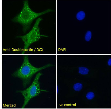 Doublecortin/DCX antibody | Anti-Doublecortin/DCX | stjohnslabs