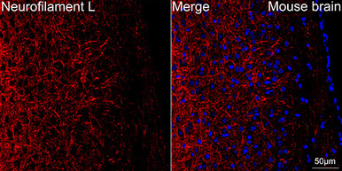 Anti-Neurofilament L rabbit monoclonal antibody [S0MR] - WB, IHC-P, IF ...