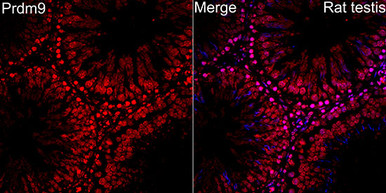 Prdm9 antibody | Anti-Prdm9 | stjohnslabs