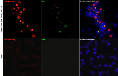 MERS-CoV Spike RBD antibody | Anti-MERS-CoV Spike RBD | stjohnslabs