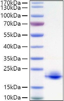 Human Myelin-oligodendrocyte glycoprotein/MOG protein (Recombinant) (C ...