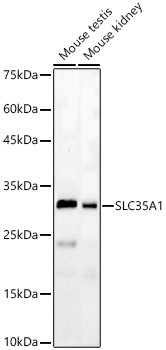 SLC35A1 antibody | Anti-SLC35A1 | stjohnslabs