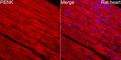 PENK antibody | Anti-PENK | stjohnslabs