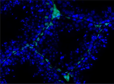 AR antibody | Anti-AR | stjohnslabs