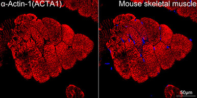 ACTA1 antibody | Anti-ACTA1 | stjohnslabs