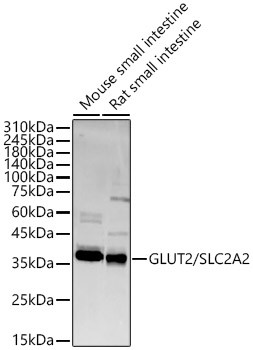 SLC2A2 antibody | Anti-SLC2A2 | stjohnslabs