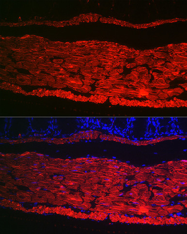 ACTA2 antibody | Anti-ACTA2 | stjohnslabs