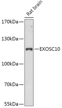 EXOSC10 antibody | Anti-EXOSC10 | stjohnslabs