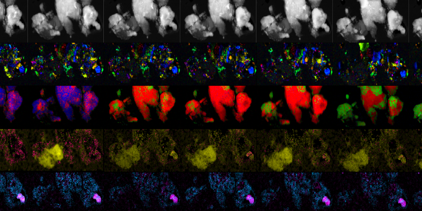 AMETEK Electron Microscopy | Gatan & EDAX